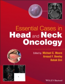 Essential Cases in Head and Neck Oncology: : 9781119775942: TGJones