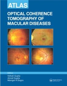 Atlas of Optical Coherence Tomography of Macular Diseases: Vishali ...