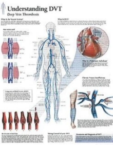 Understanding DVT Laminated Poster: Scientific Publishing ...