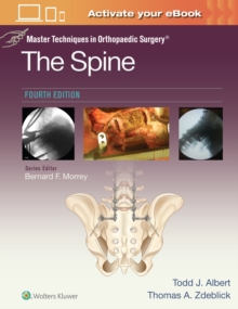 Master Techniques in Orthopaedic Surgery: The Spine: Todd, MD Albert ...