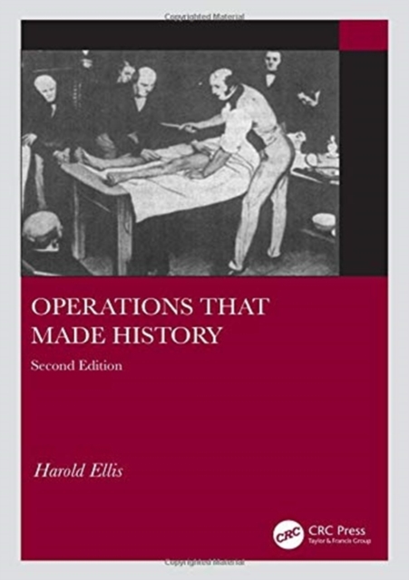 Operations that made History 2e: Harold (King's College London Guy's ...