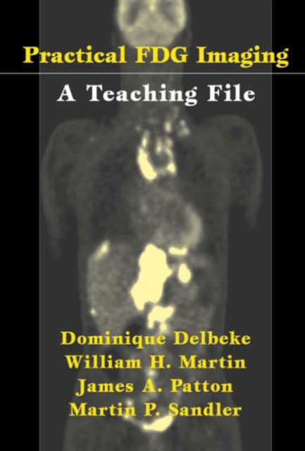 Practical FDG Imaging : A Teaching File: : 9780387952925: TGJones