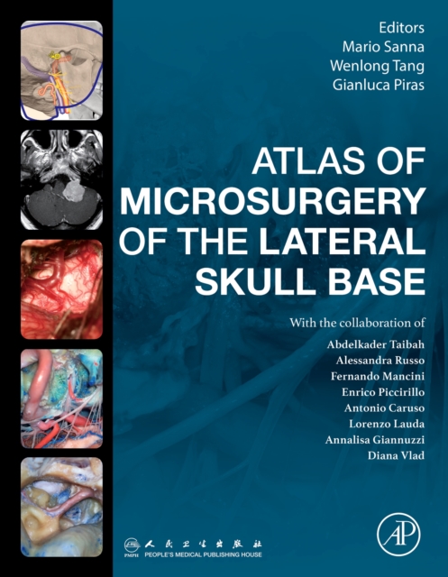 Atlas of Microsurgery of the Lateral Skull Base: Mario (Founder and ...