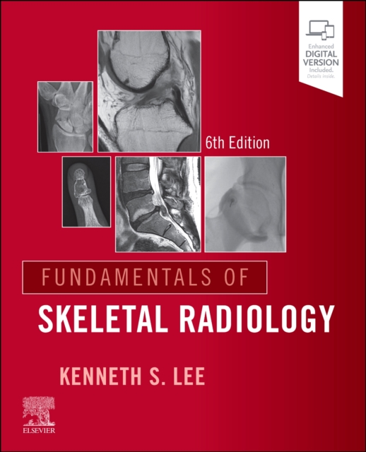 Fundamentals of Skeletal Radiology: Kenneth S., MD (Professor and ...