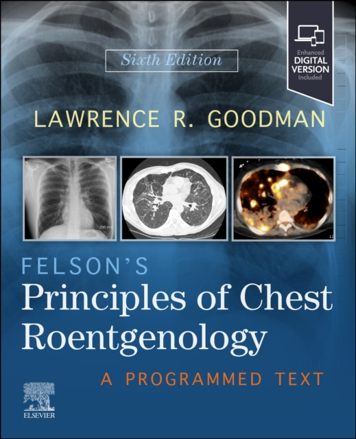 Felson's Principles of Chest Roentgenology : A Programmed Text ...