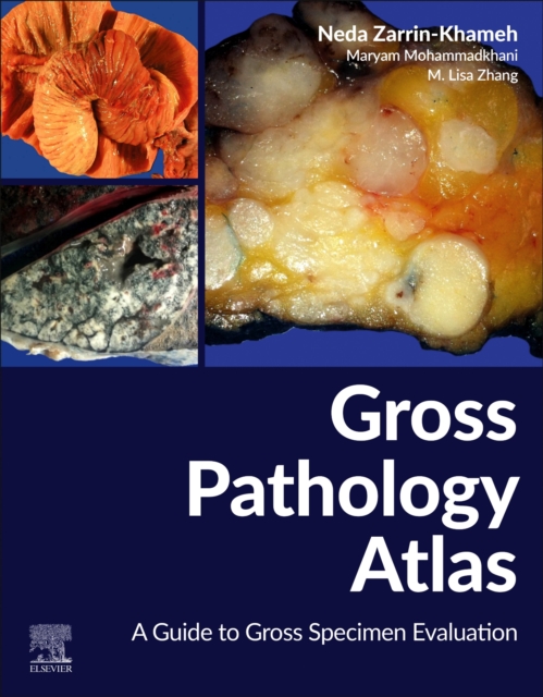 Gross Pathology Atlas : A Guide to Gross Specimens Evaluation: Neda, MD ...