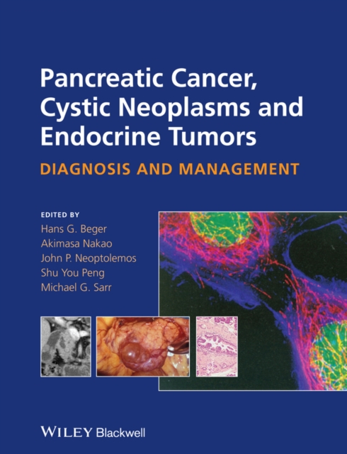Pancreatic Cancer, Cystic Neoplasms and Endocrine Tumors : Diagnosis ...
