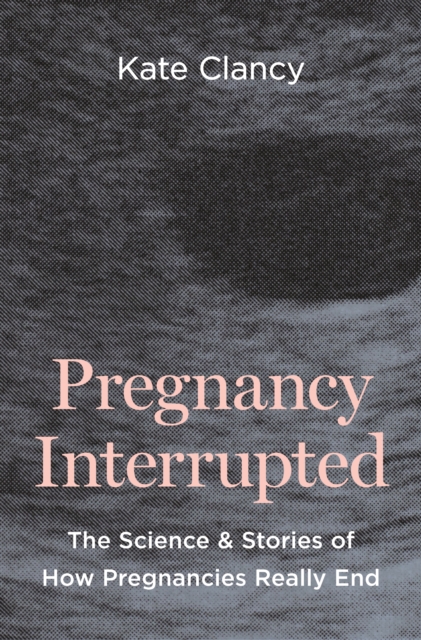 Pregnancy Interrupted : The Science and Stories of How Pregnancies ...