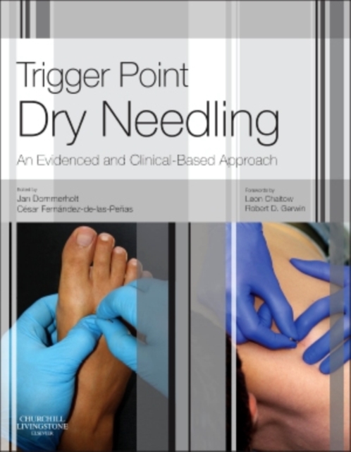 Trigger Point Dry Needling : An Evidence and Clinical-Based Approach ...