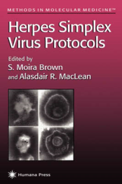 Herpes Simplex Virus Protocols: : 9780896033474: TGJones
