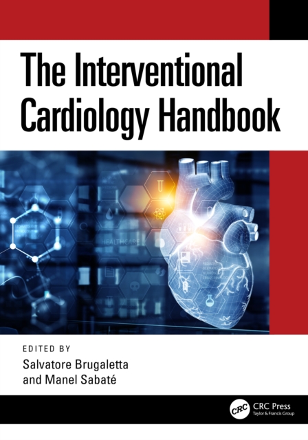 The Interventional Cardiology Handbook: : 9781032606910: TGJones