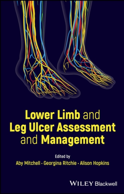 Lower Limb and Leg Ulcer Assessment and Management: : 9781119908210 ...