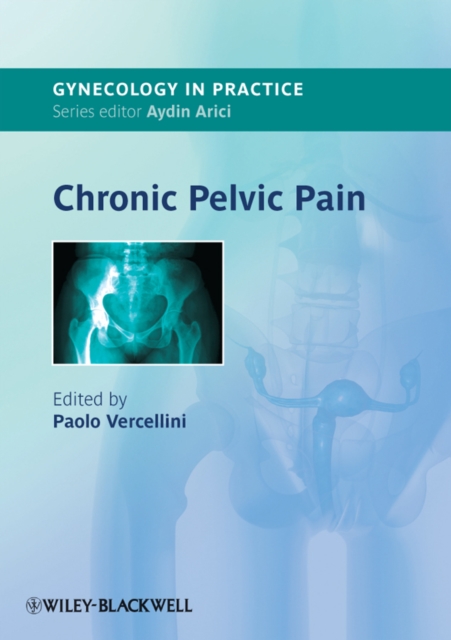 Chronic Pelvic Pain: : 9781444330663: TGJones