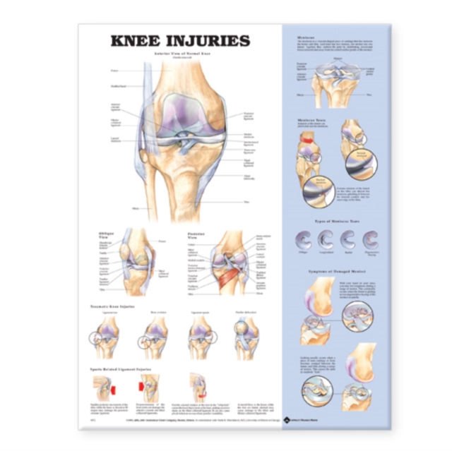 Knee Injuries Anatomical Chart: : 9781587796968: TGJones