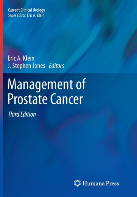 Management of Prostate Cancer: : 9781617797392: TGJones