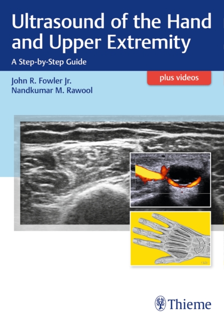 Ultrasound of the Hand and Upper Extremity : A Step-by-Step Guide ...