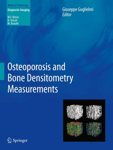 Osteoporosis and Bone Densitometry Measurements: : 9783642278839: TGJones