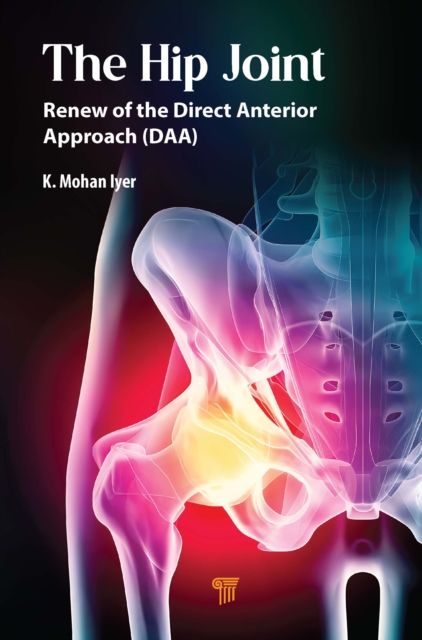 The Hip Joint : Renew of the Direct Anterior Approach (DAA ...
